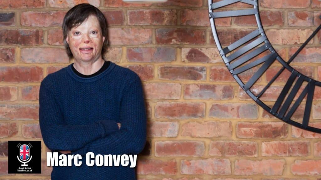 Marc Convey | Inspirational speaker | Burns Survivor